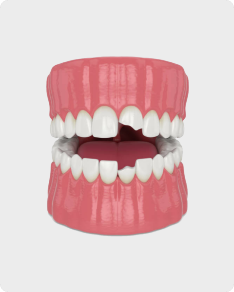 Knocked Out Tooth – Waikiki Dental Center